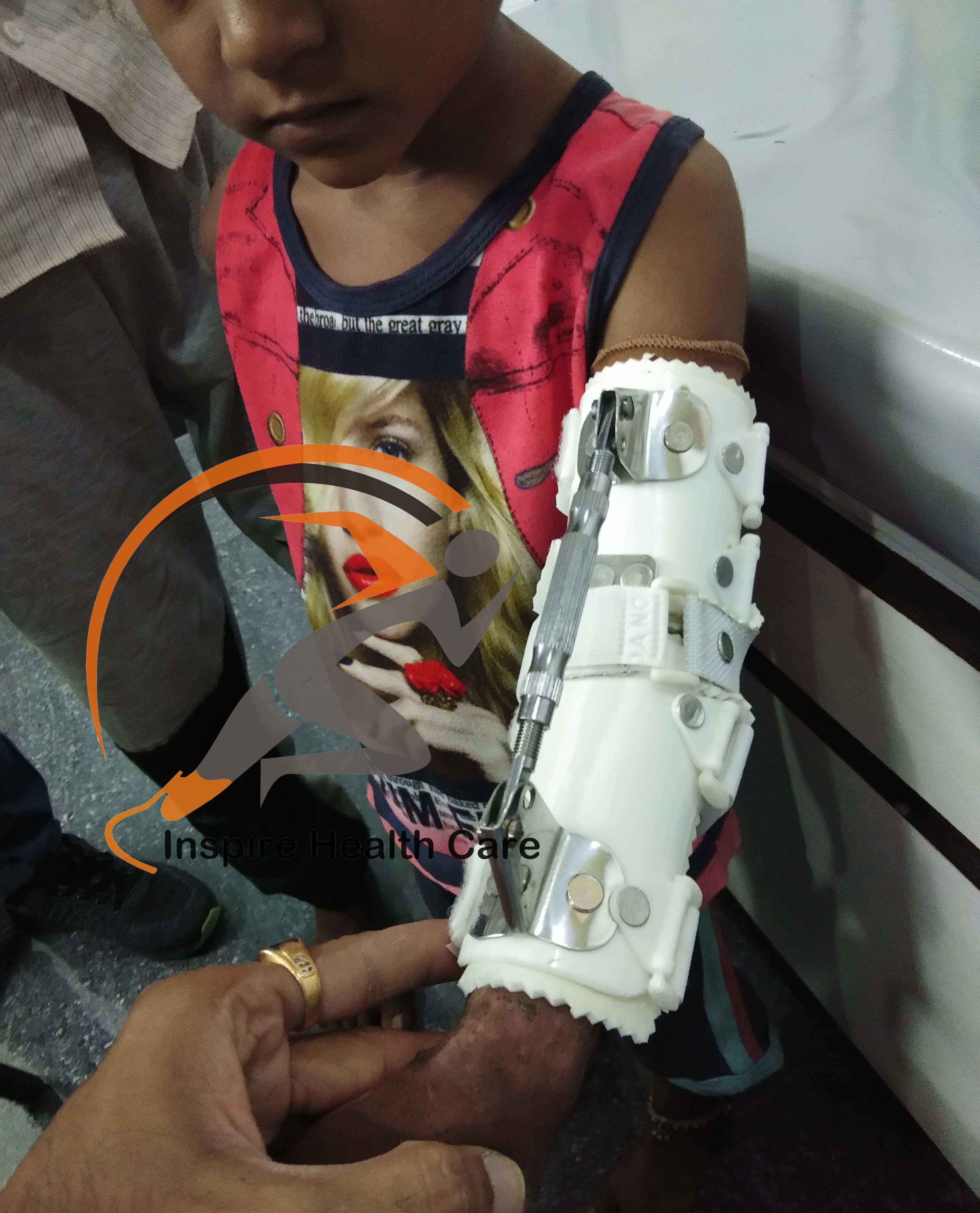 Inspire Structure | Post Operative Fracture / Burns Splints