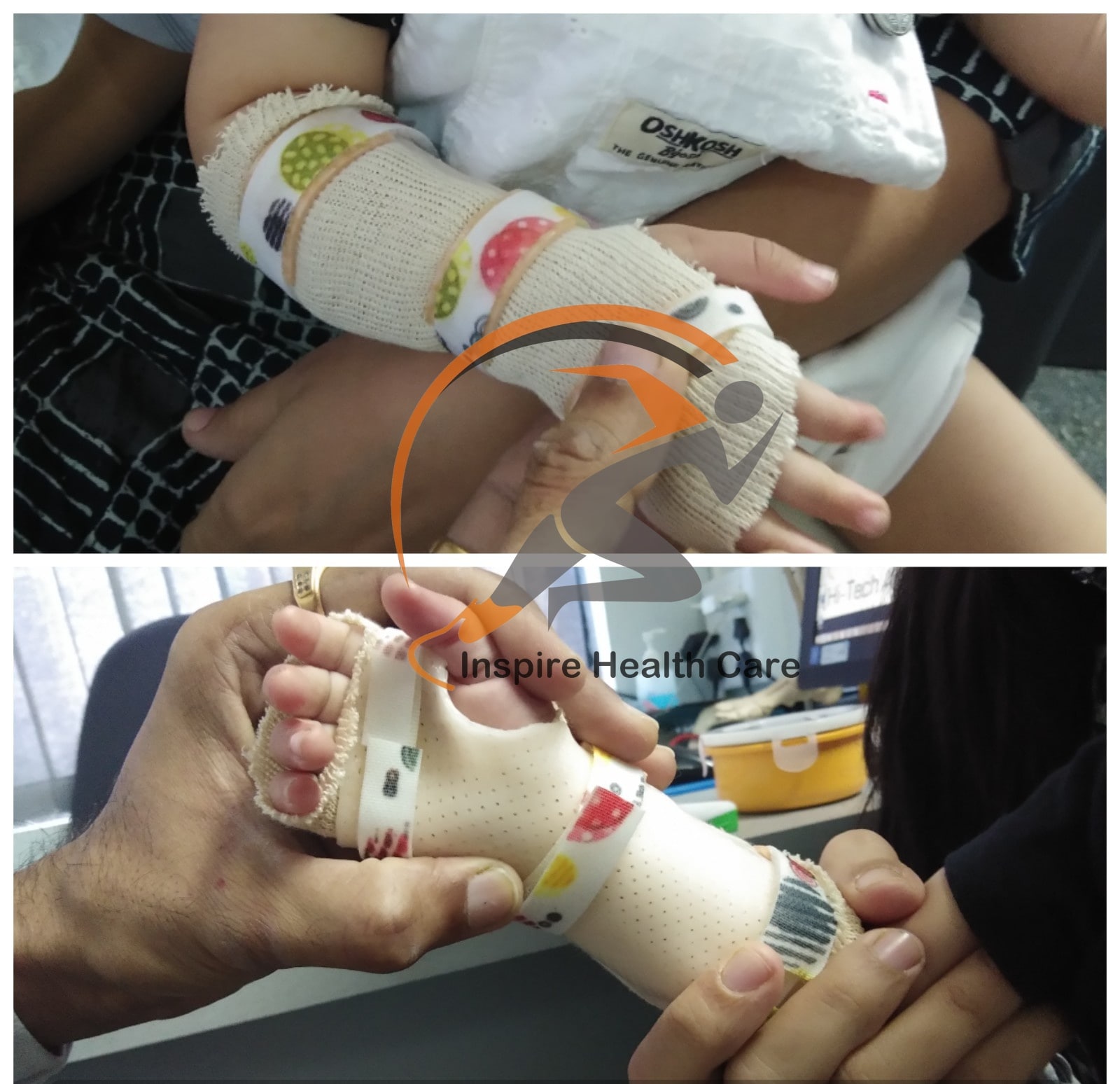 Inspire Structure | Low Temperature Thermo Plastic Splinting